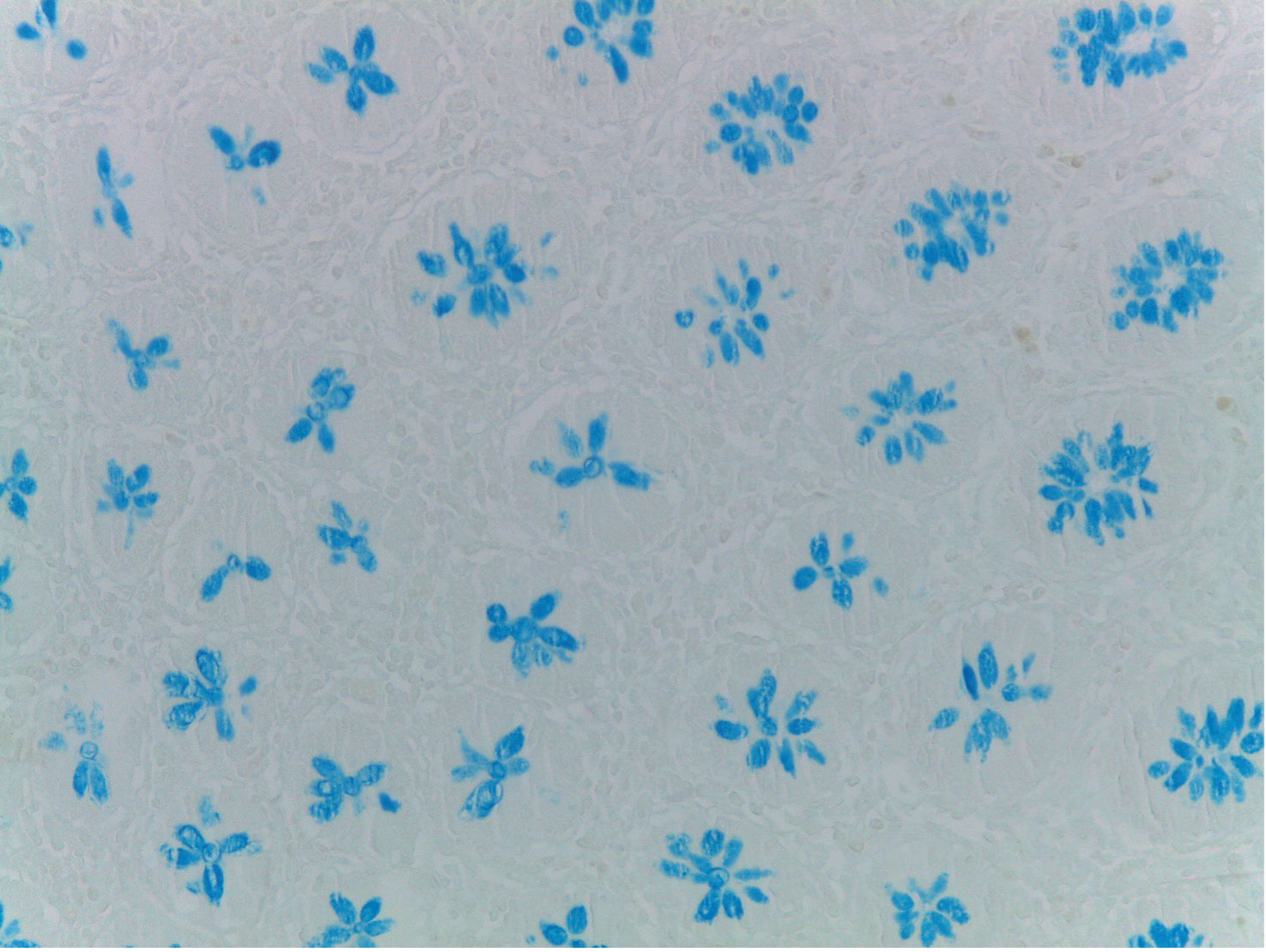 Special Stain Alcian Blue pH 1.5 acc. Dorling – Diapath Special Stain Alcian Blue pH 1.5 acc. Dorling – Diapath