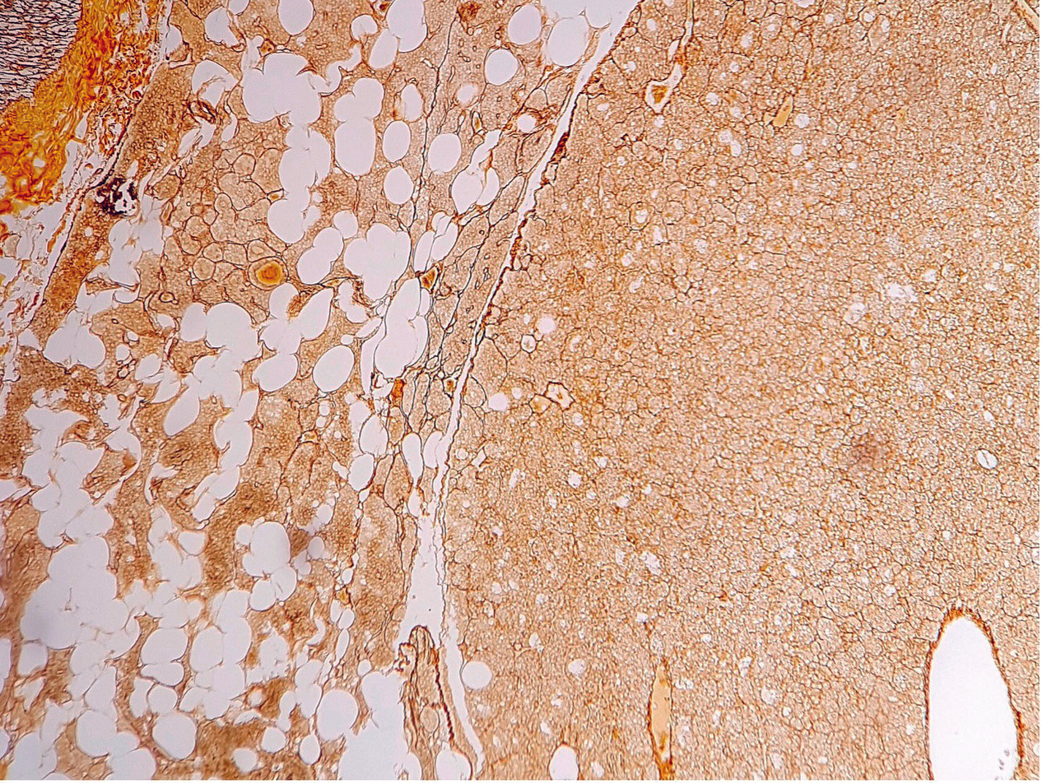 Special Stain Silver Impregnation – Diapath