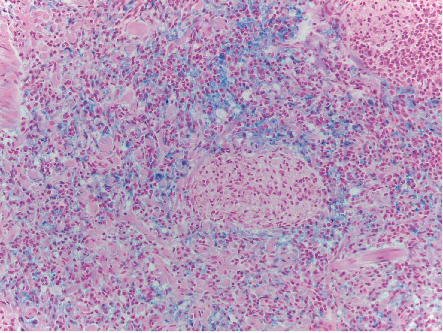 Special Stain Perls – Diapath