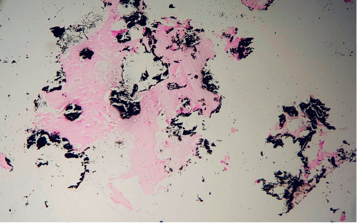 Special Stain Von Kossa acc. McGee-Russel – Diapath