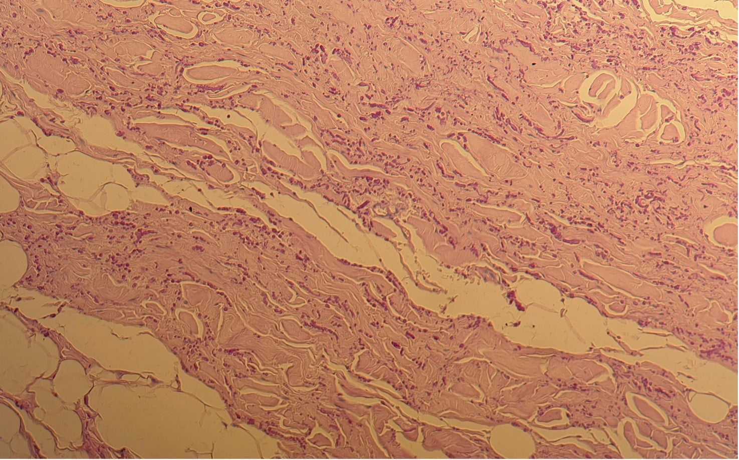 Special Stain Weigert for elastic fibers, fast method – Diapath