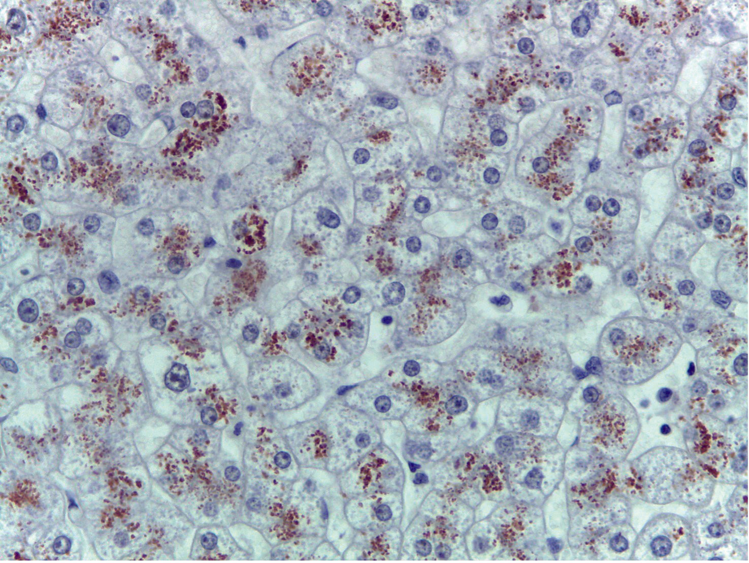 Special Stain Rhodamine – Diapath