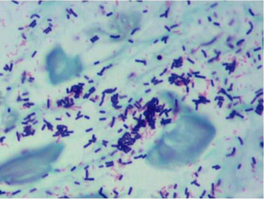 Special Stain Twort – Diapath