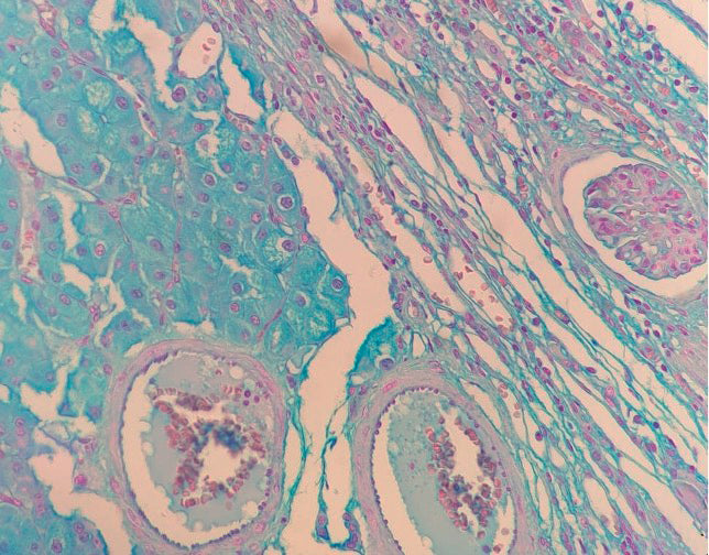 Special Stain Hale reaction – Diapath