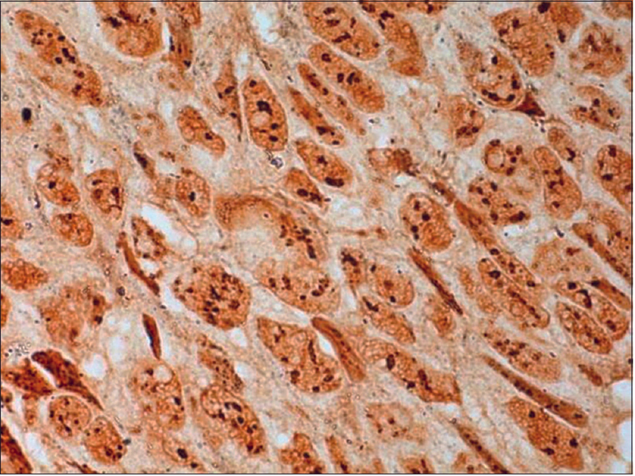 Special Stain AgNOR – Diapath