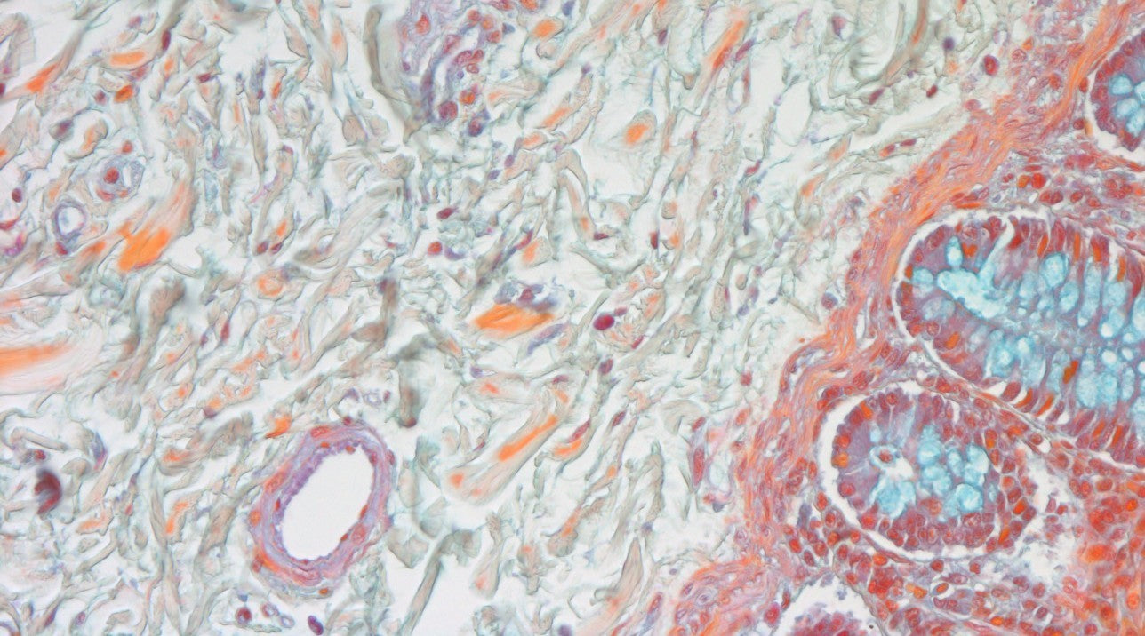 Special Stain Dane’s Stain – Diapath